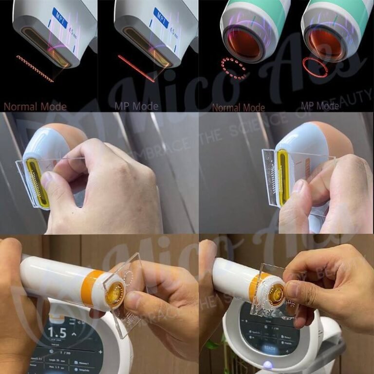 Ultraformer MPT MMFU Micro Pulse 7D Hifu MPT Machine For Anti-aging ...