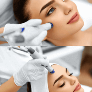 Cosmetic Treatments - Mico Aes