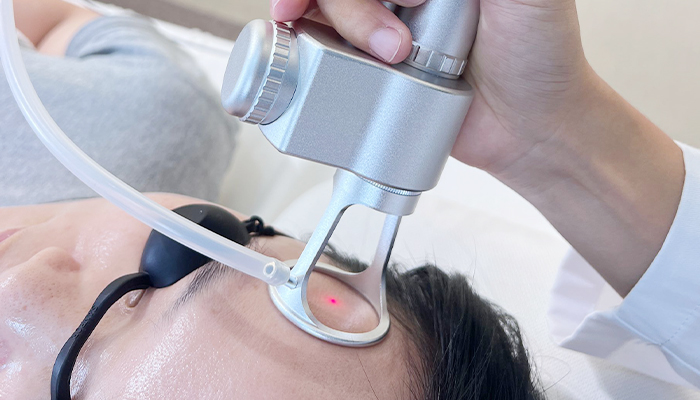 Microneedling vs. Laser Skin Resurfacing Machine: Which is Right for ...